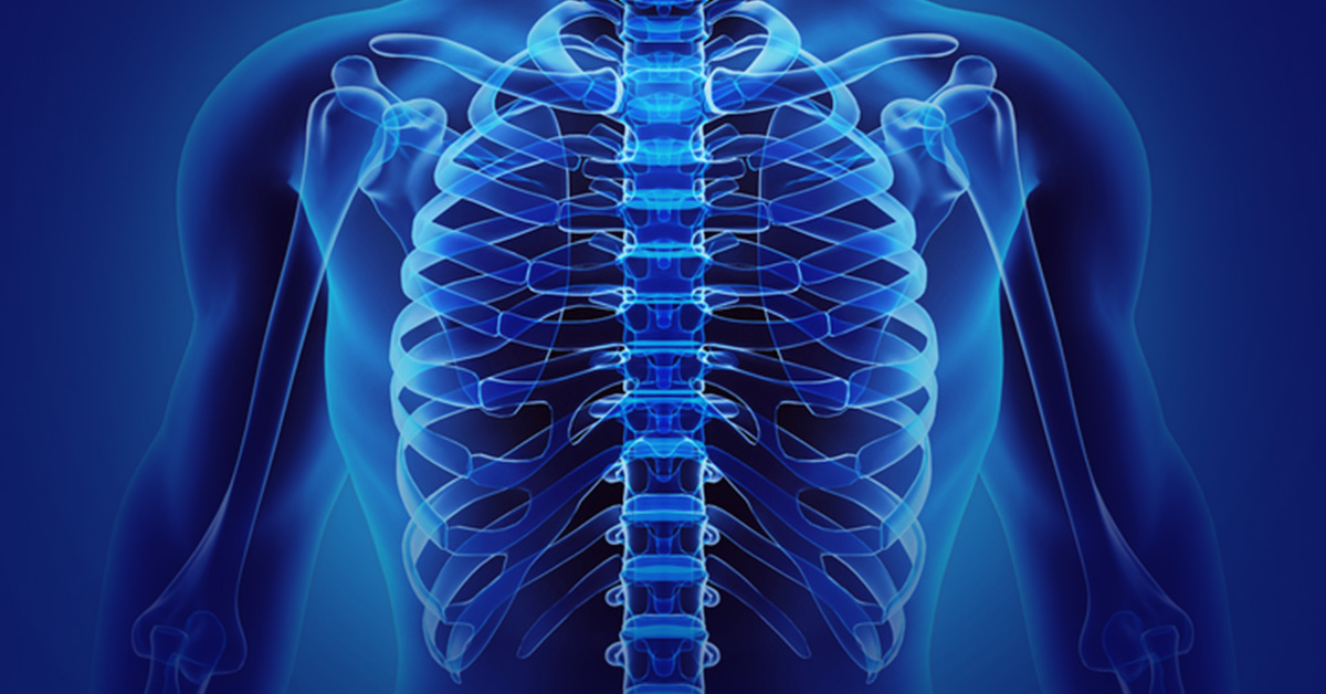 Thoracic Outlet Syndrome | Symptoms, Causes, & Types | MedStar Health