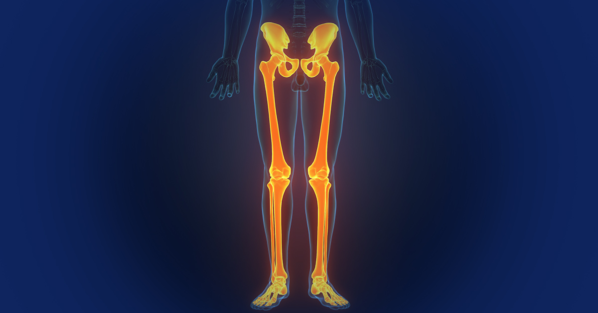 What Is Claudication? | Symptoms & Treatment | MedStar Health