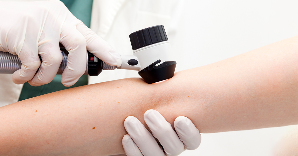 Non-Surgical Cosmetic Dermatology Procedures | MedStar Health