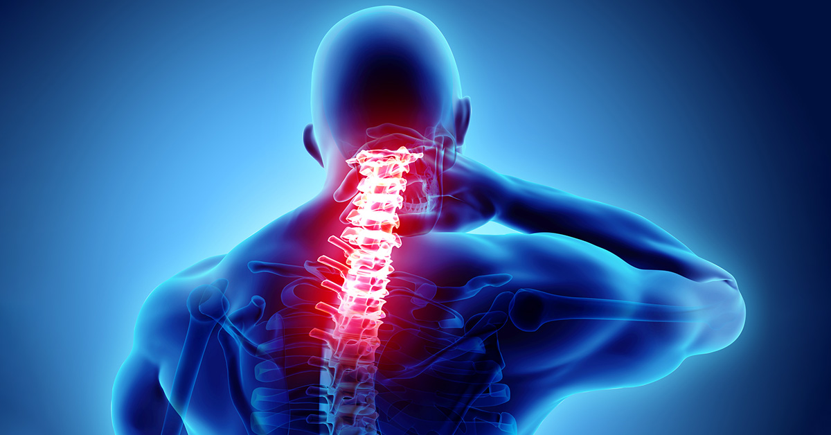 Neck Fracture in Washington DC, Baltimore, Maryland, Virginia | MedStar ...